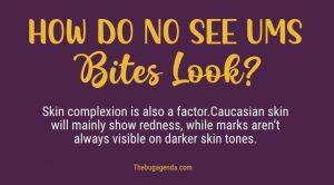 No See Um Bites: All You Need to Know -- The Bug Agenda